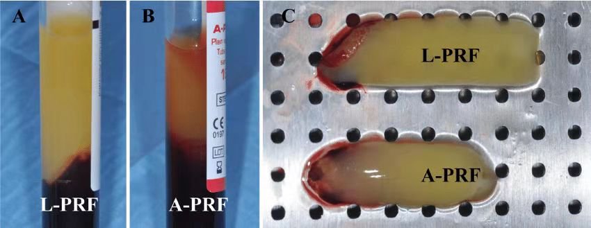 PRF tube – PRP tube – plasma rich platelet